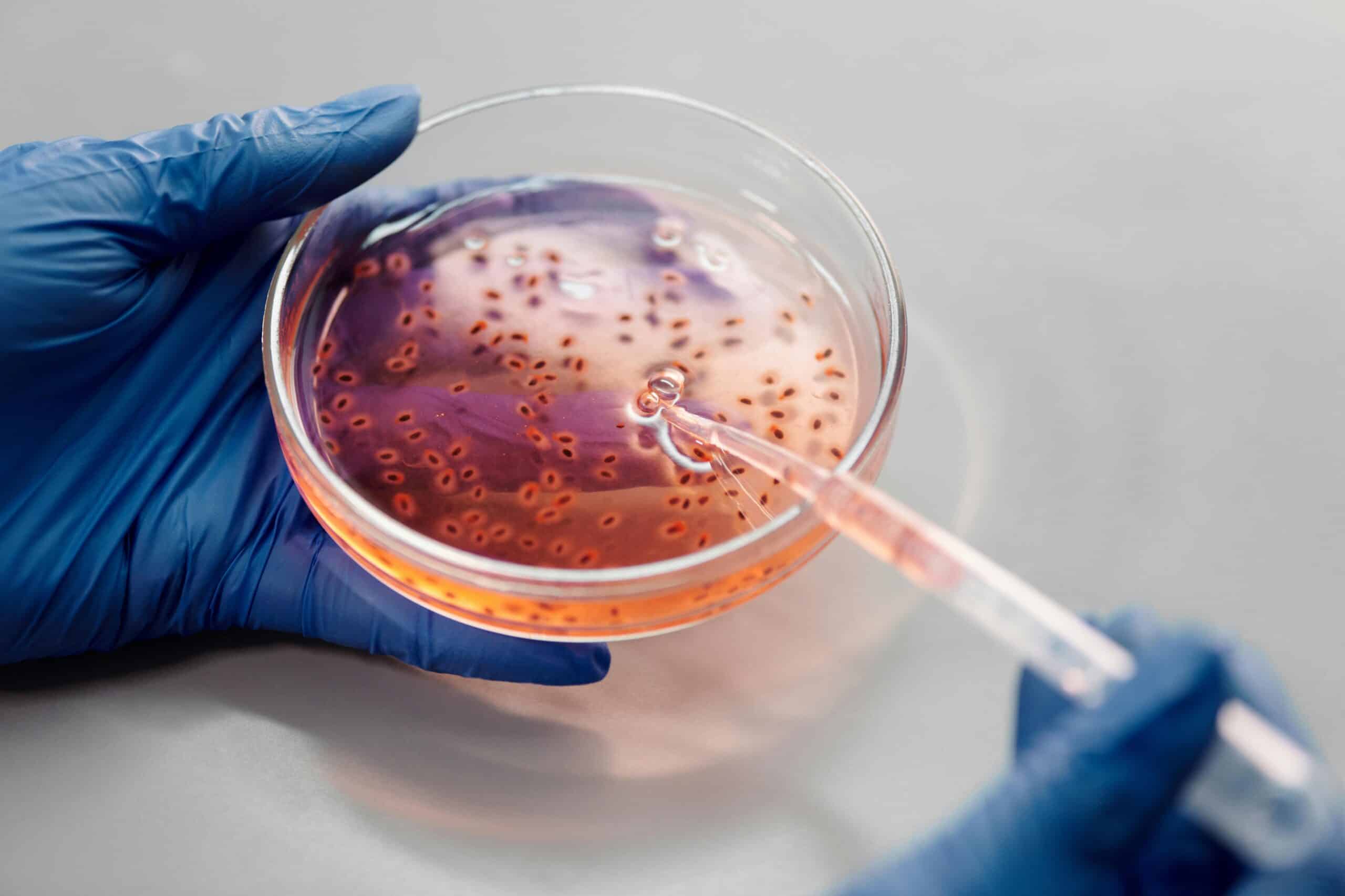 Platforms or Software Used in Genetic Data Analysis » EXAMRADAR